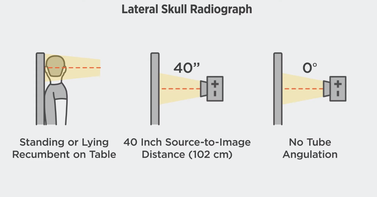 Lateral Skull X-ray Guide: Radiologist's Handbook - HSIN FILM