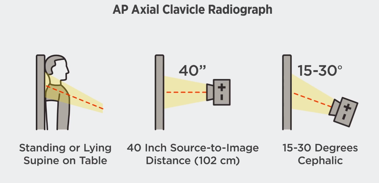 Clavicle X-ray Positioning in Radiography: Cracking the Code - HSIN FILM