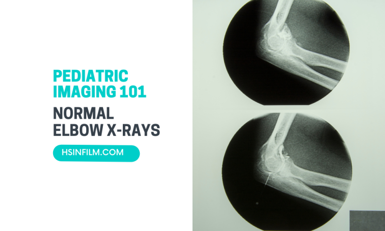 Normal Pediatric Elbow X-rays Radiography 101 - HSIN FILM