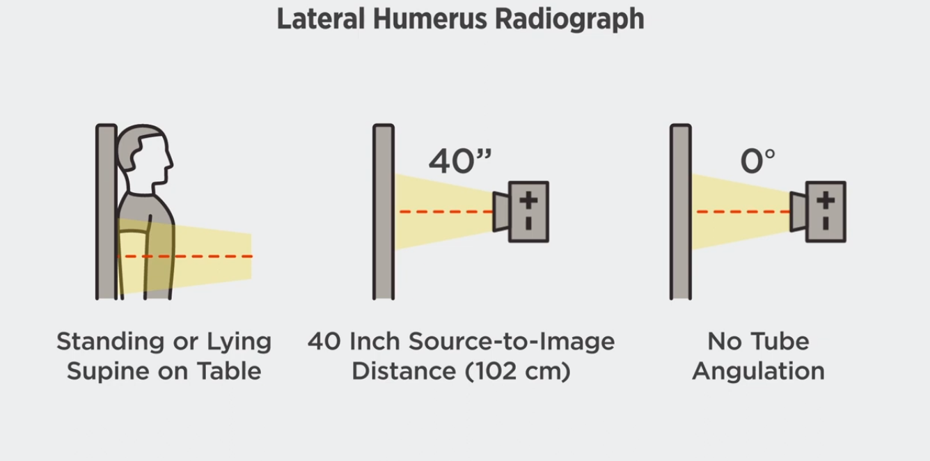 Optimal Lateral Humerus X-rays Positioning: The Radiographer's Guide ...