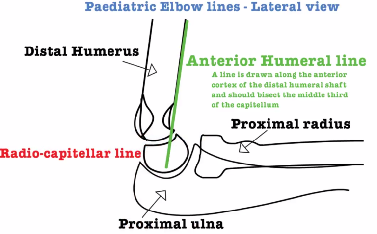 Normal Pediatric Elbow X-rays Radiography 101 - HSIN FILM